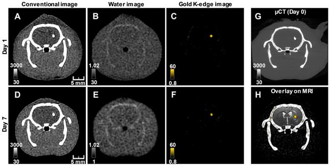 Multicolor spectral photon counting CT monitors and quantifies ...