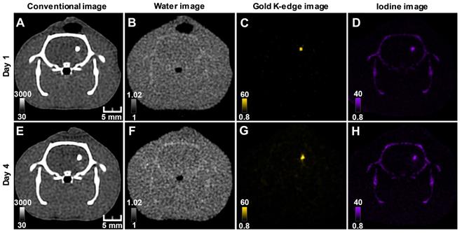 Multicolor spectral photon counting CT monitors and quantifies ...