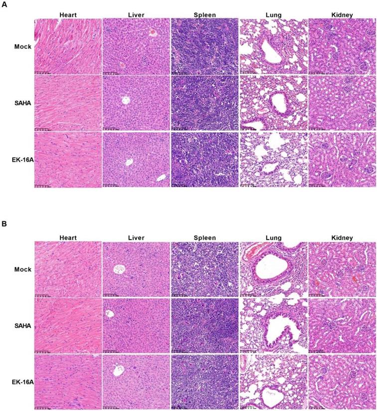 EK-16A liposomes enhance HIV replication in ACH2 or J-Lat 10.6 cell ...