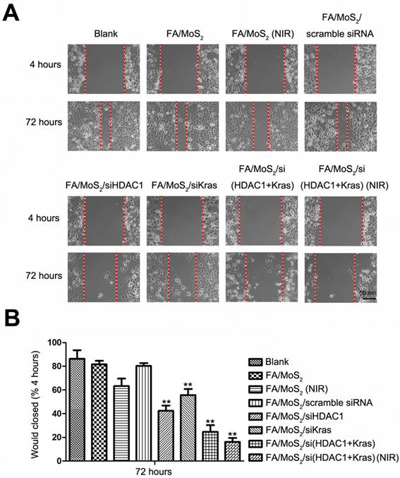 Functionalized MoS2 Nanosheets as Multi-Gene Delivery Vehicles for In Vivo Pancreatic Cancer Therapy