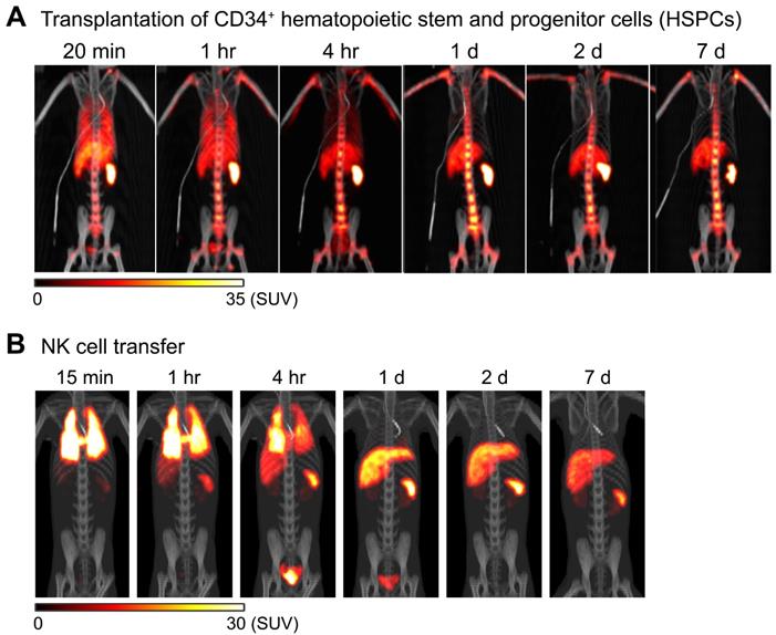 Imaging of cell-based therapy using 89Zr-oxine ex vivo cell labeling ...